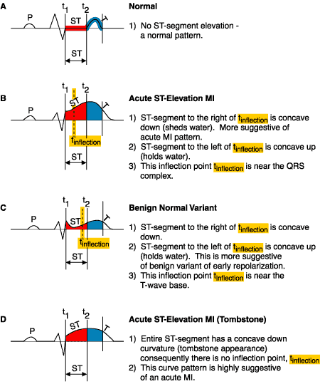 St Elevation Tombstone